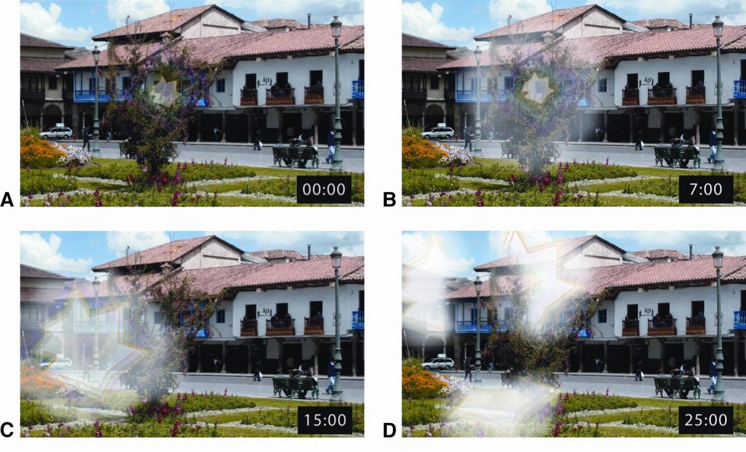 Ocular Migraine | Grace & Vision Optometrist Brisbane